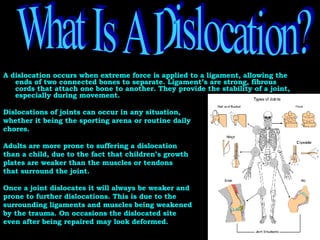 Dislocations | PPT