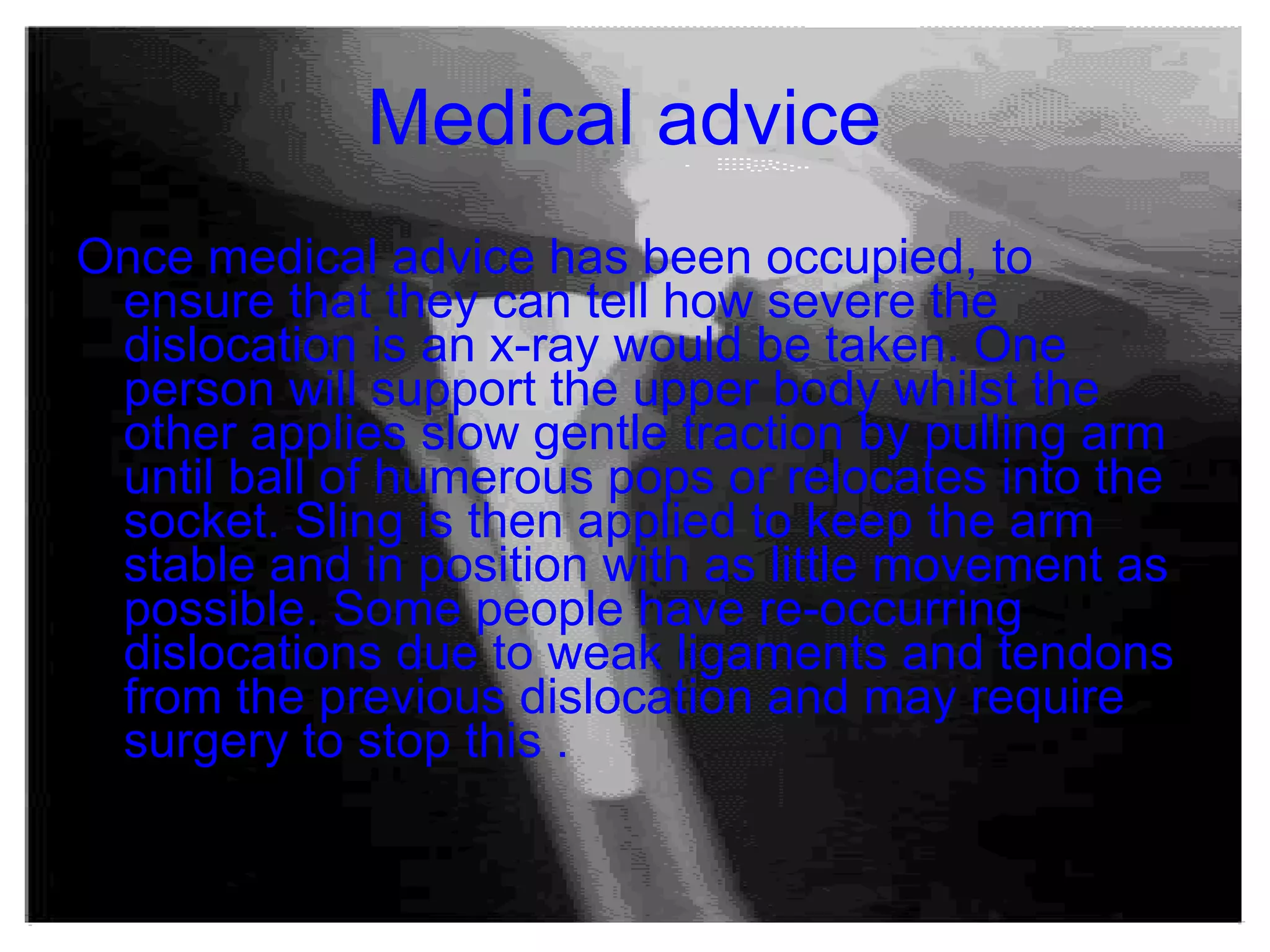 Dislocations | PPT