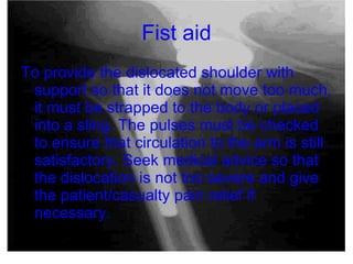 Dislocations | PPT
