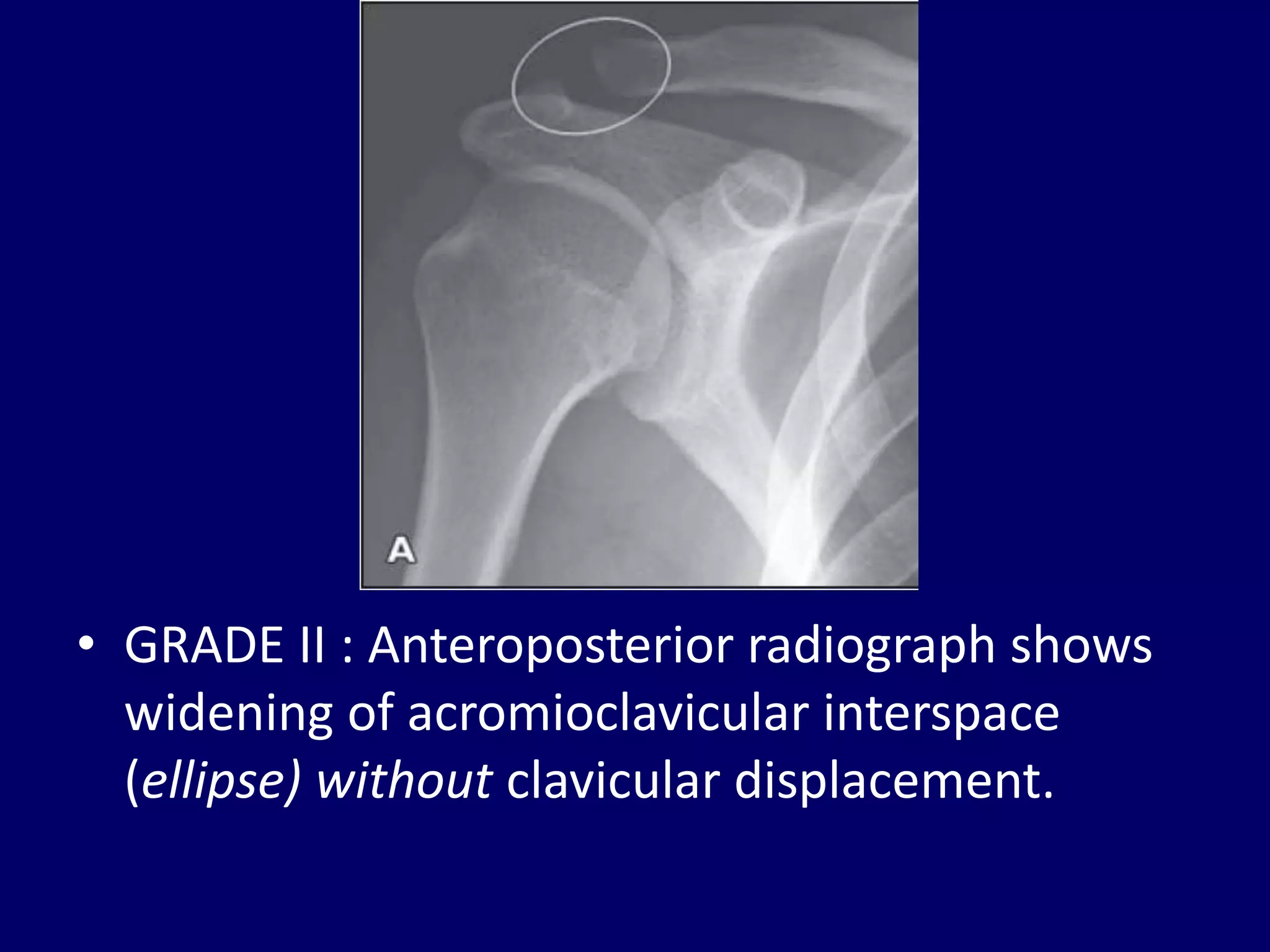 Dislocations of joint. Joint Dislocation | PPTX