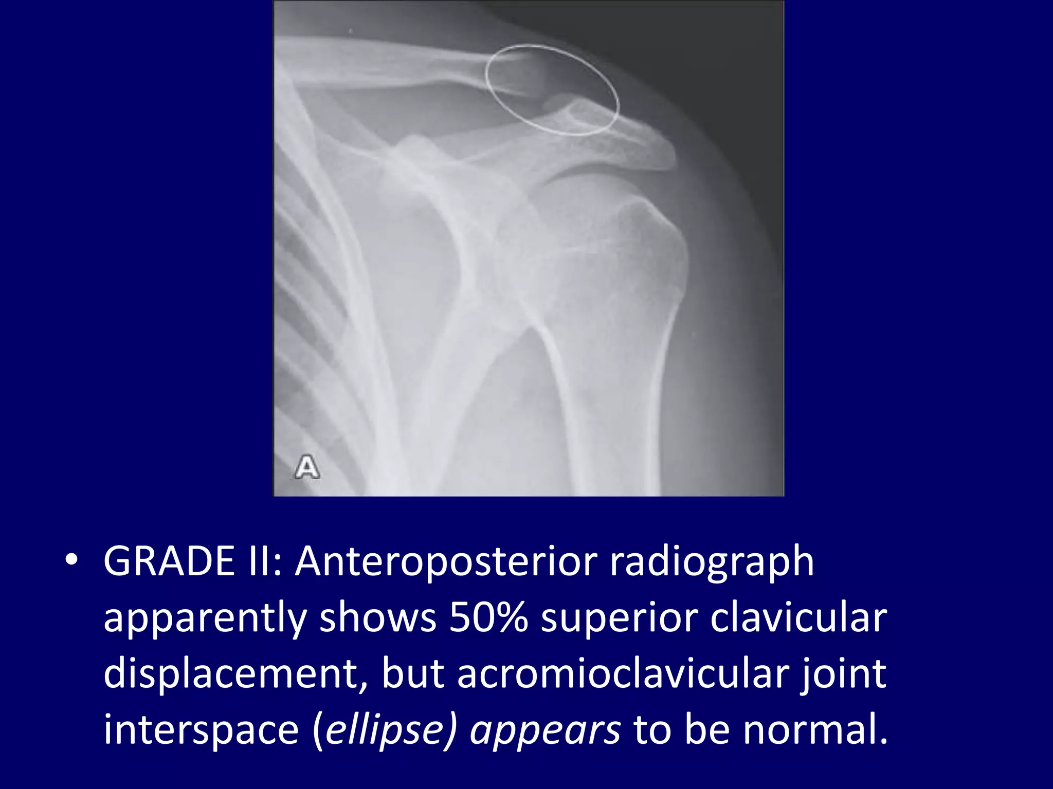 Dislocations of joint. Joint Dislocation | PPTX