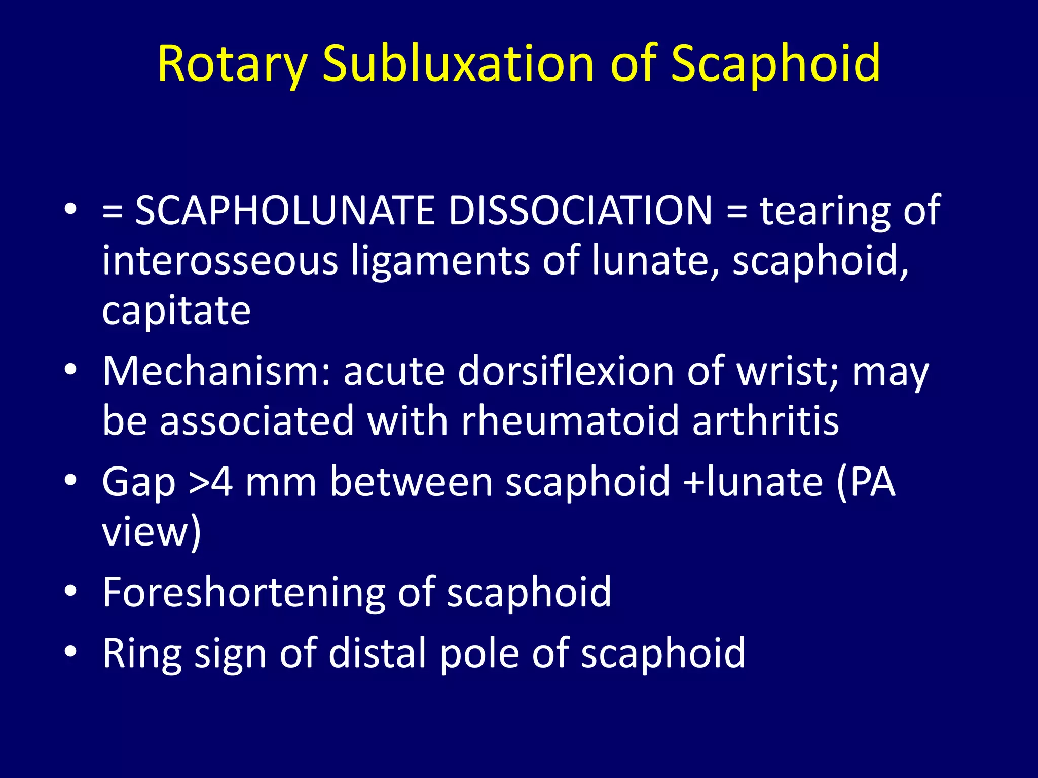 Dislocations Of Joint Joint Dislocation Ppt