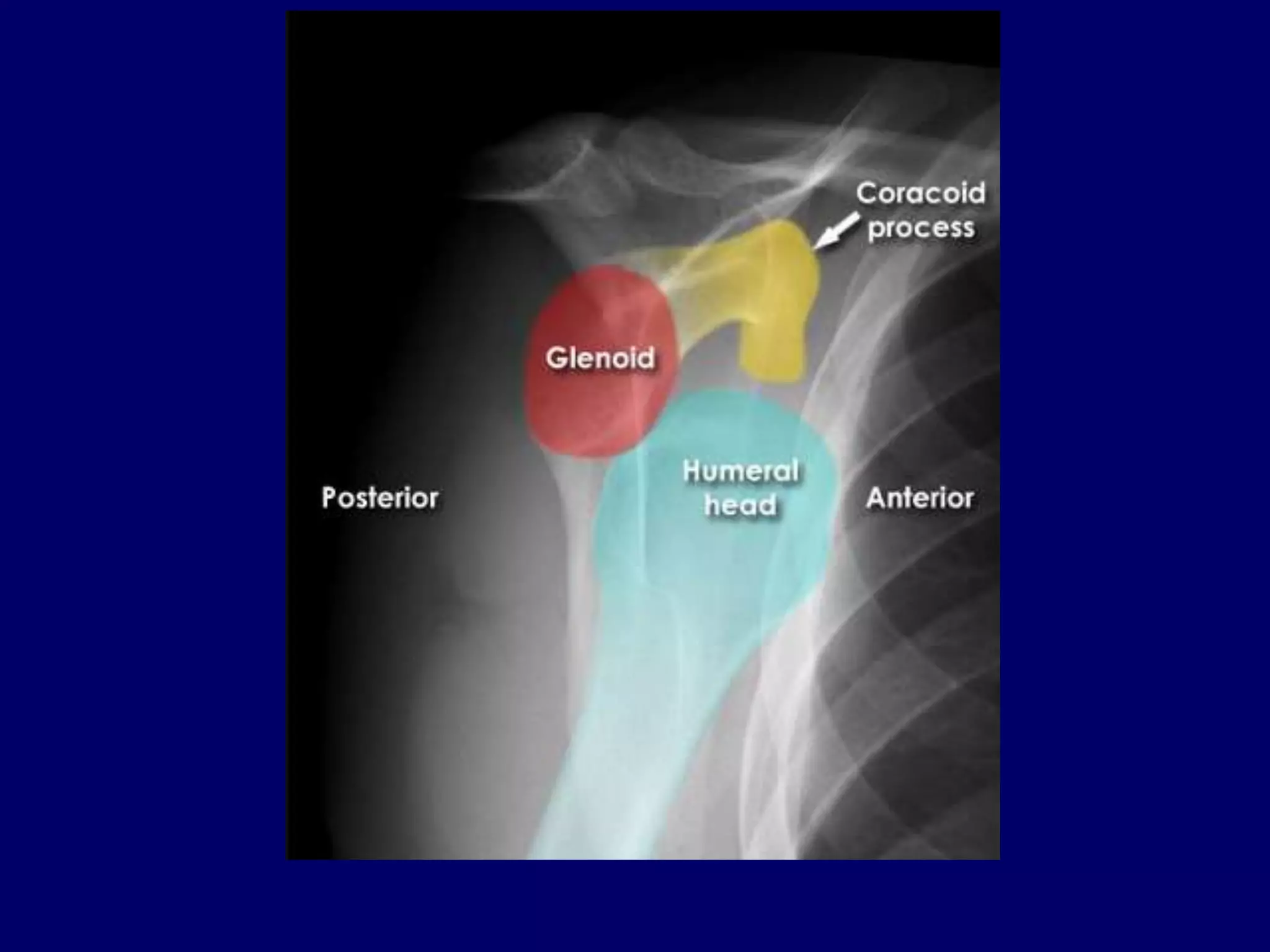 Dislocations of joint. Joint Dislocation | PPTX
