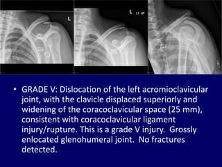 Dislocations of joint. Joint Dislocation | PPTX