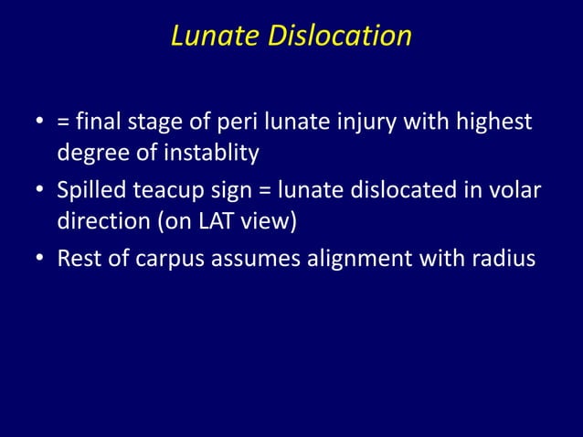 Dislocations of joint. Joint Dislocation | PPTX | Death, Injury, or ...