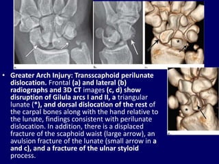Dislocations of joint. Joint Dislocation | PPTX