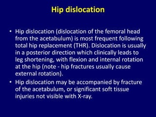 Dislocations of joint. Joint Dislocation | PPTX