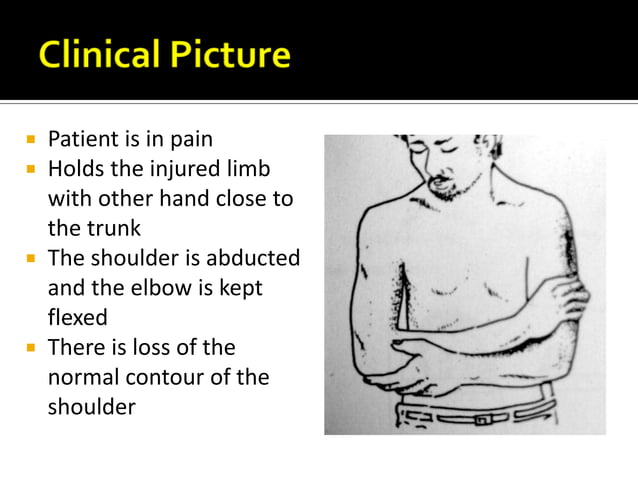 Dislocations of the Upper Extremity .pptx