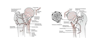 Dislokasi Panggul.pptx