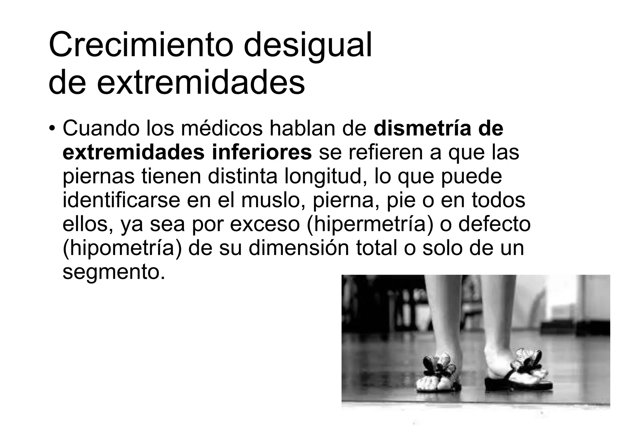 Dismetría o una pierna más larga que otra | PPT