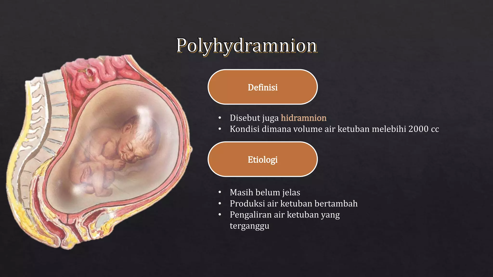 Disorder of Amniotic Fluid Volume | PPTX