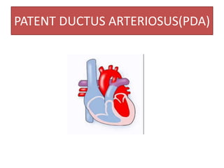 Disorder of cardiovascular system | PPTX