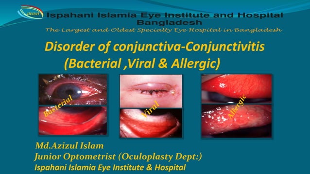 Conjunctivitis | PPTX | Eye and Vision Conditions | Diseases and Conditions