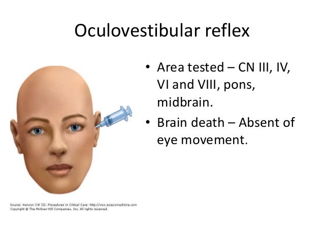 Disorder of consciousness