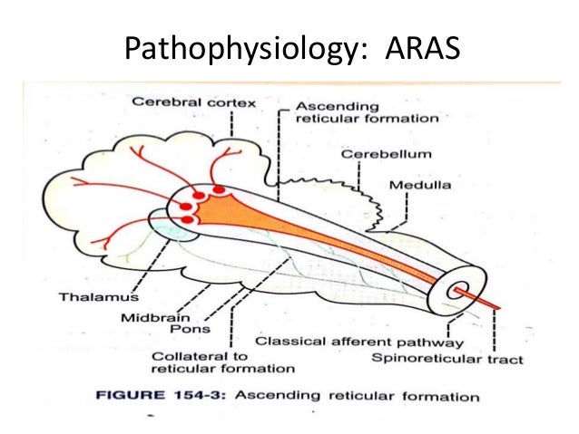 Disorder of consciousness