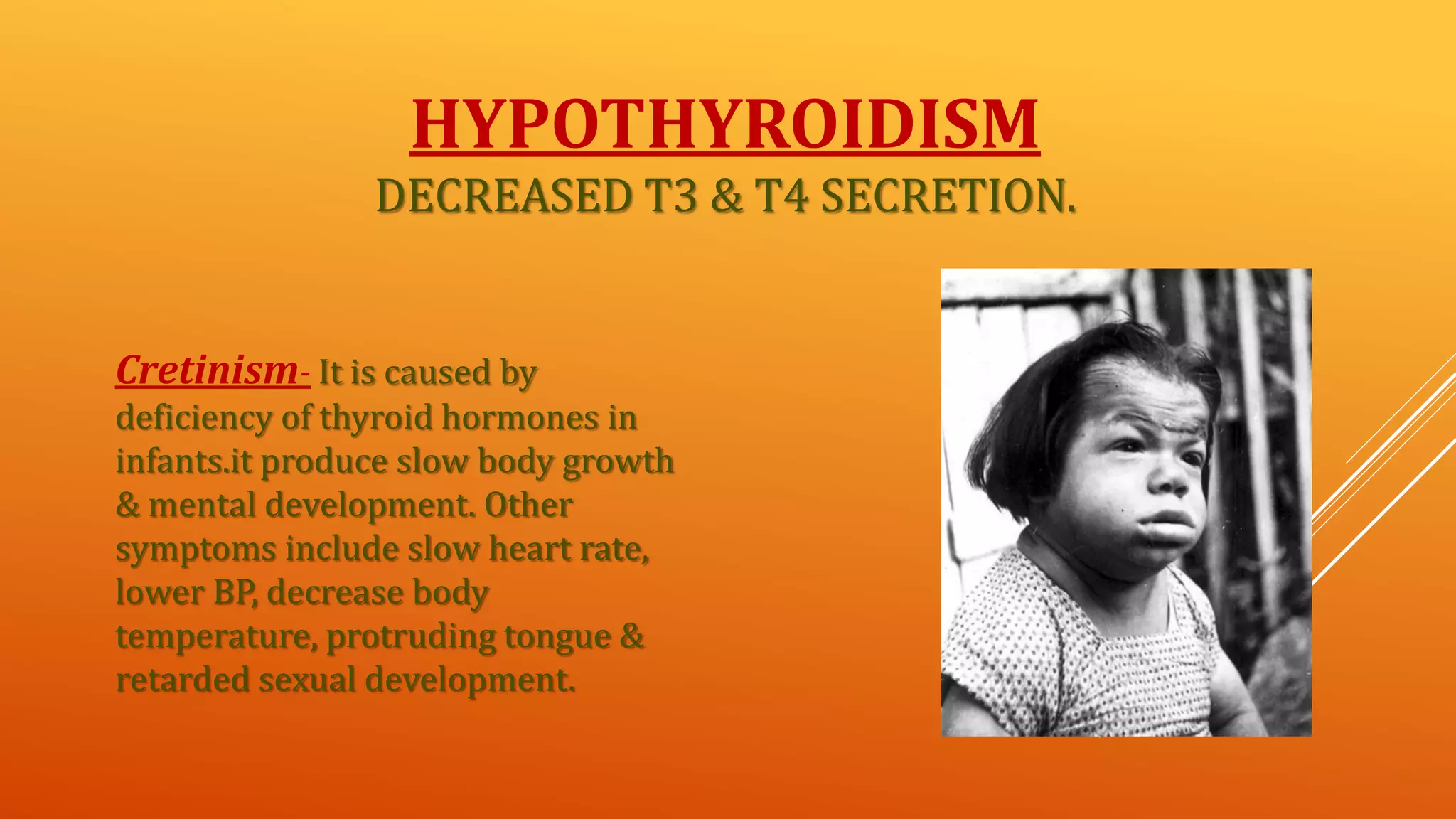 Disorder of endocrine system | PPTX