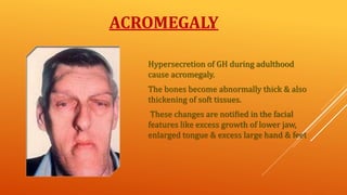 Disorder of endocrine system | PPTX