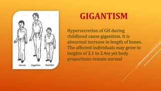 Disorder of endocrine system | PPTX