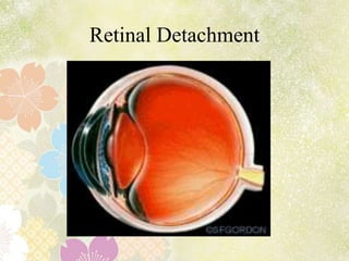Disorder of retina | PPTX
