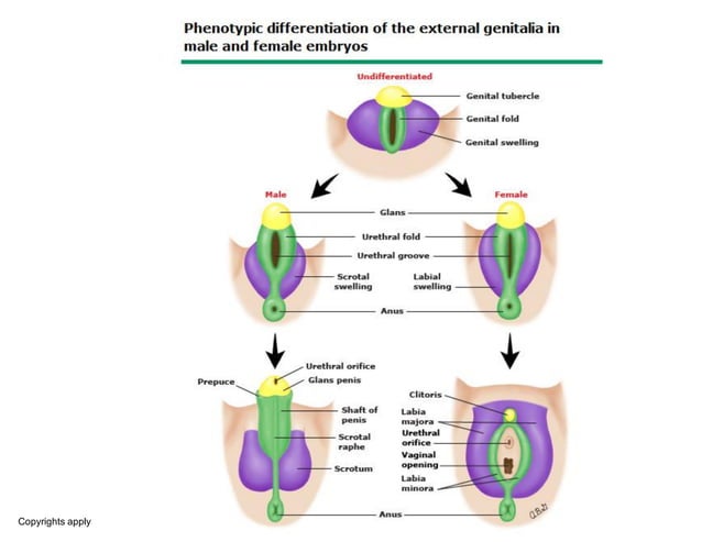 Disorder Of Sex Development Pdf