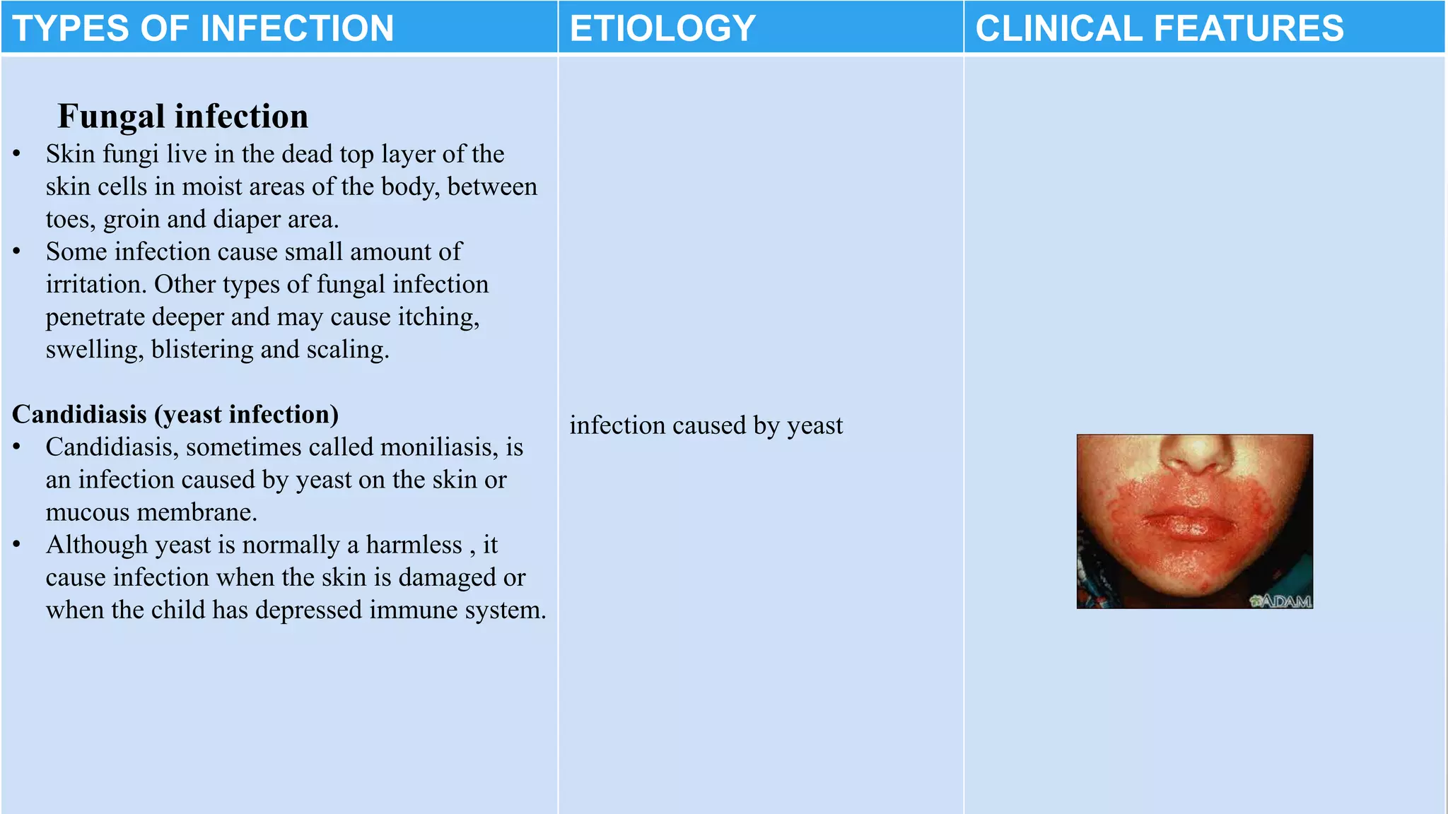 disorder of skin viji.pptx