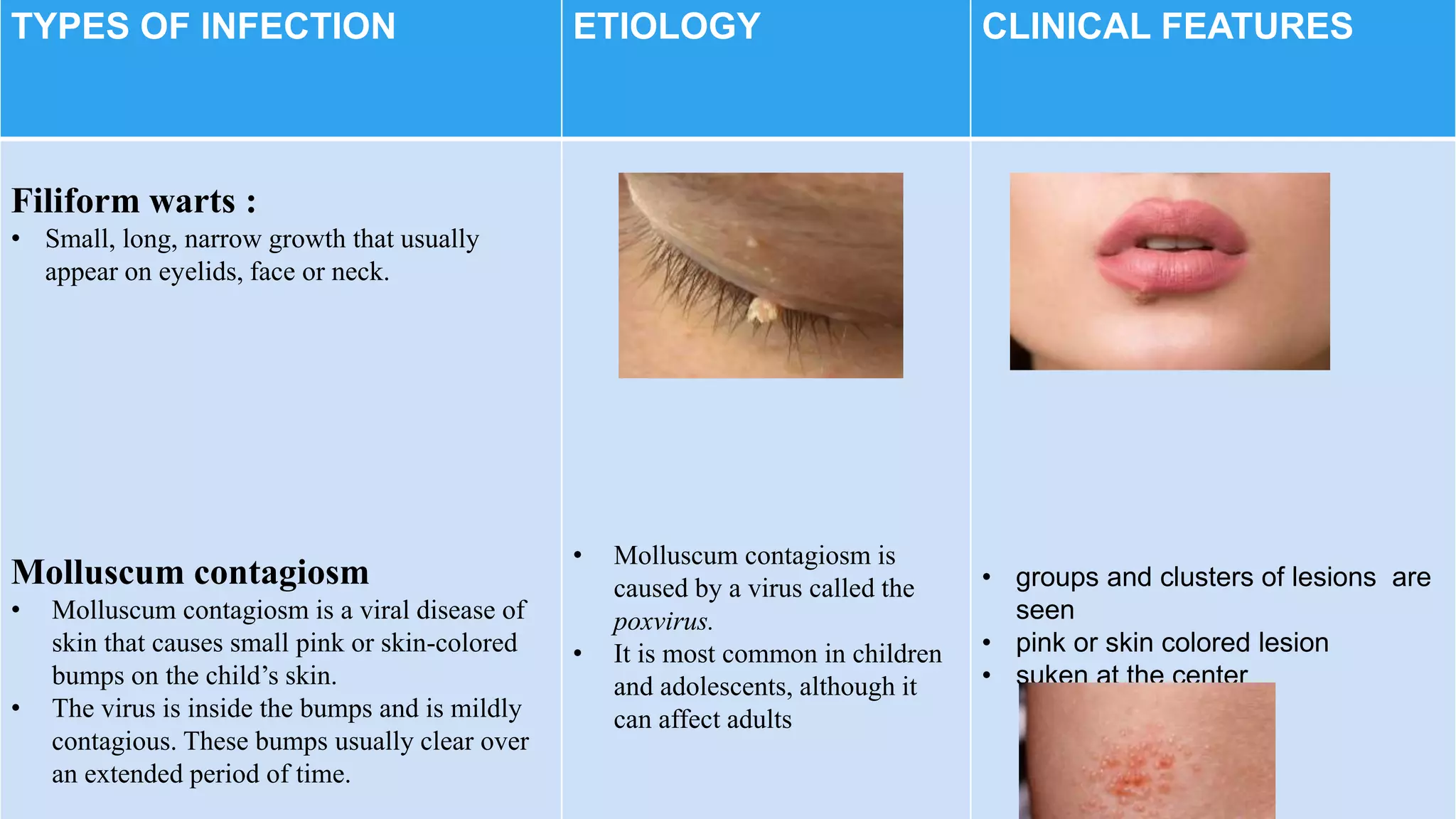 disorder of skin viji.pptx