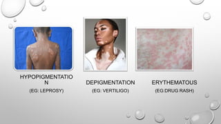 disorder of skin viji.pptx