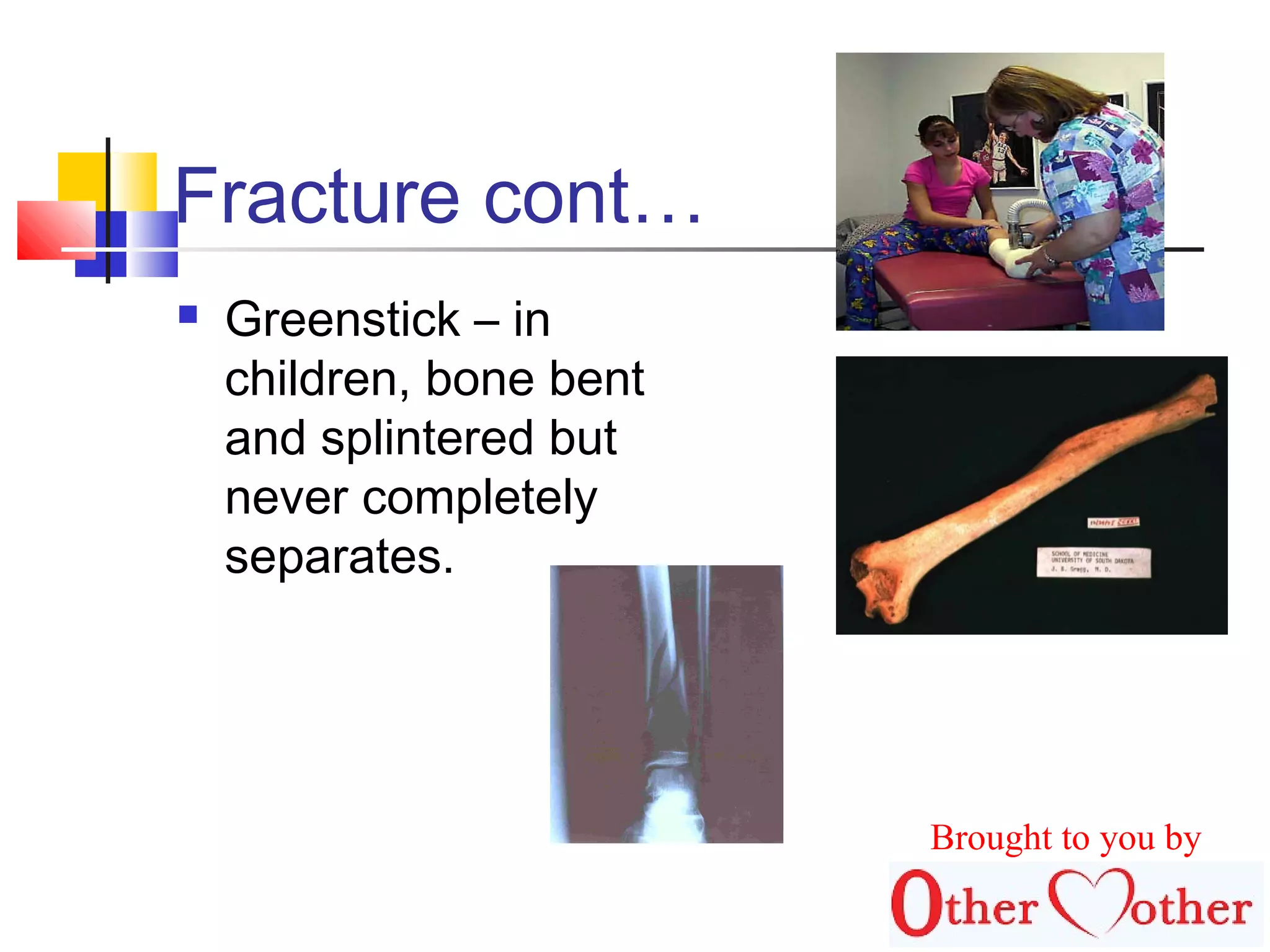Disorder of the bones and joints… | PPT