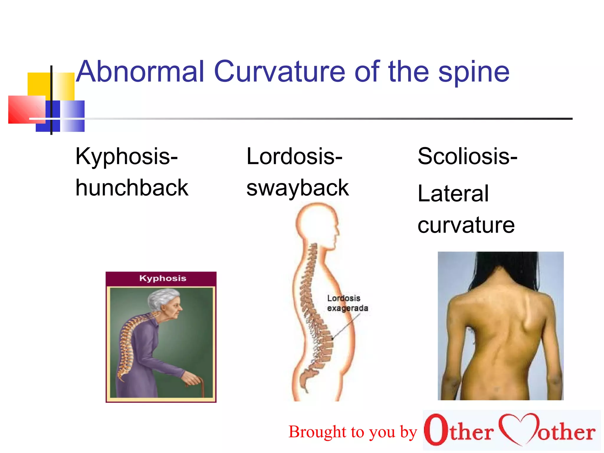 Disorder of the bones and joints… | PPT