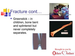 Disorder of the bones and joints… | PPT