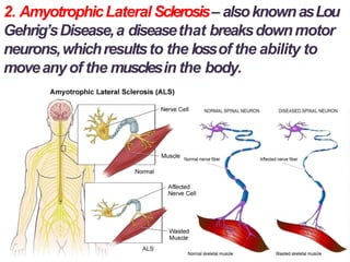 disorderofthenervoussystem-130718081459-phpapp02.pptx