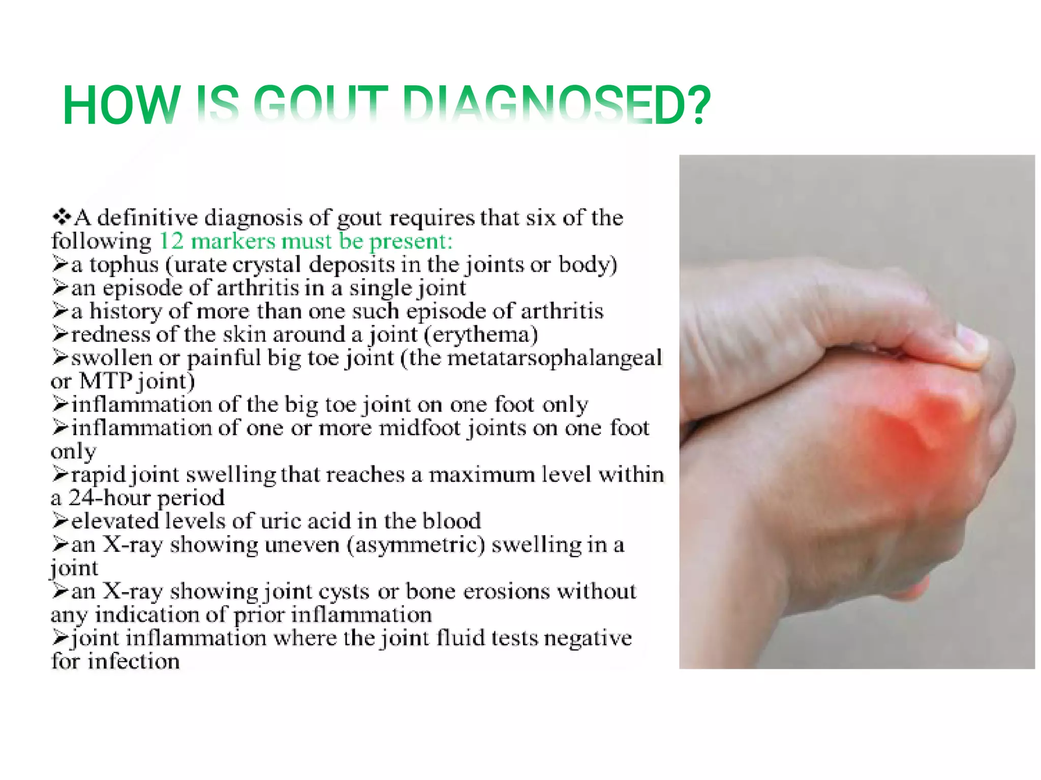 DISORDER OF URIC METABOLISM -GOUT-INVESTIGATIONS AND DIAGNOSIS.pdf