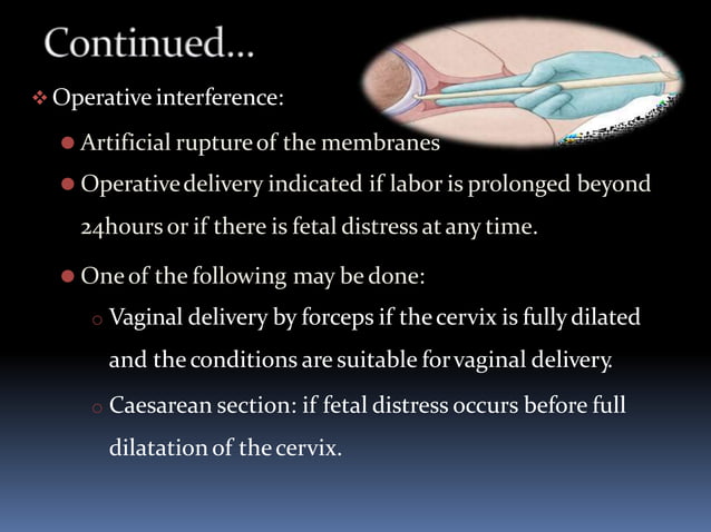Disorder of uterine contraction & precipitate labour.pptx