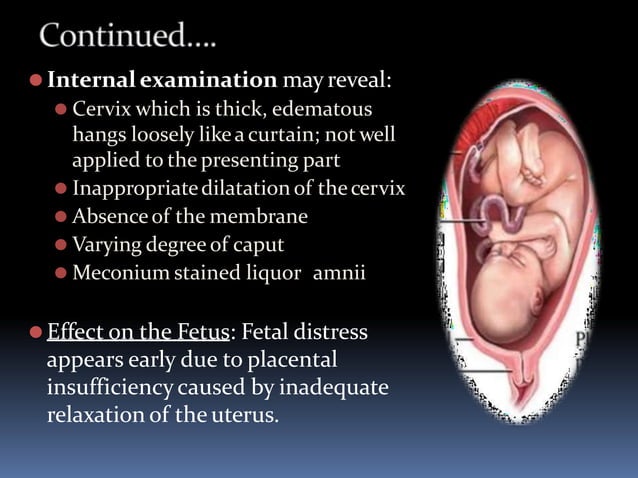 Disorder of uterine contraction & precipitate labour.pptx