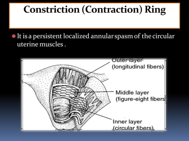 Disorder of uterine contraction & precipitate labour.pptx