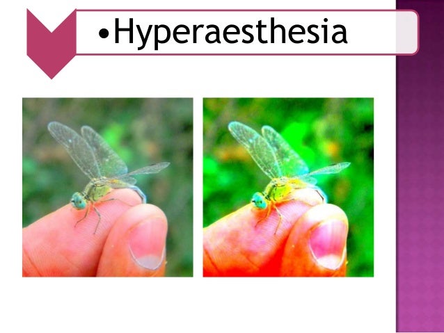 Disorders Of Perception