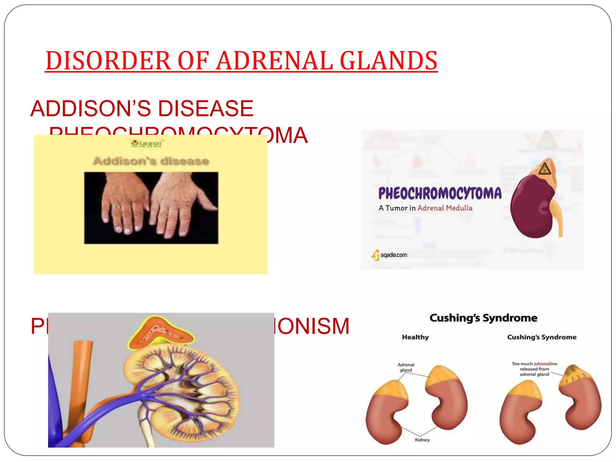Disorders of adrenal glands | PPTX