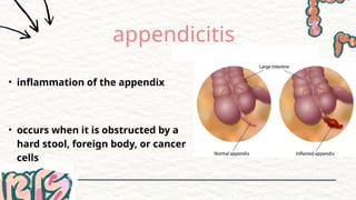 DISORDERS and DISEASES of Digestive Systems.pptx