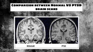 Psychological Disorders ppt | PPTX | Brain and Nervous System Disorders | Diseases and Conditions