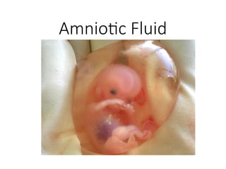 Disorders of amniotic fluid in Gynaecology pptx | PPTX