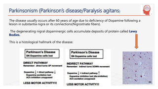 Disorders of basal nuclei | PPTX