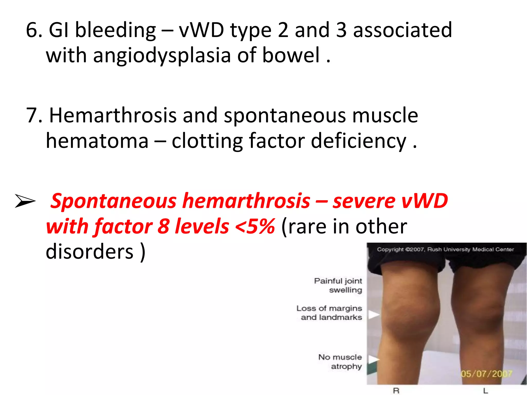 Disorders of bleeding and thrombosis | PDF