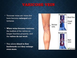 Disorders of Blood Vessels (Pathology).ppt