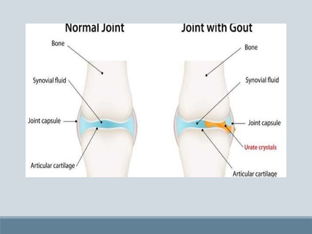 Disorders of Bones and Joints Pharm d.pptx