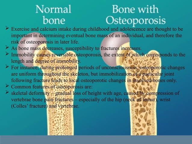 Disorders of Bones and Joints Pharm d.pptx