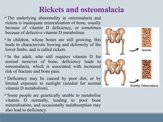 Disorders of Bones and Joints Pharm d.pptx
