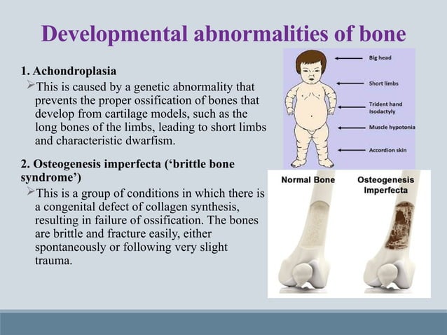 Disorders of Bones and Joints Pharm d.pptx