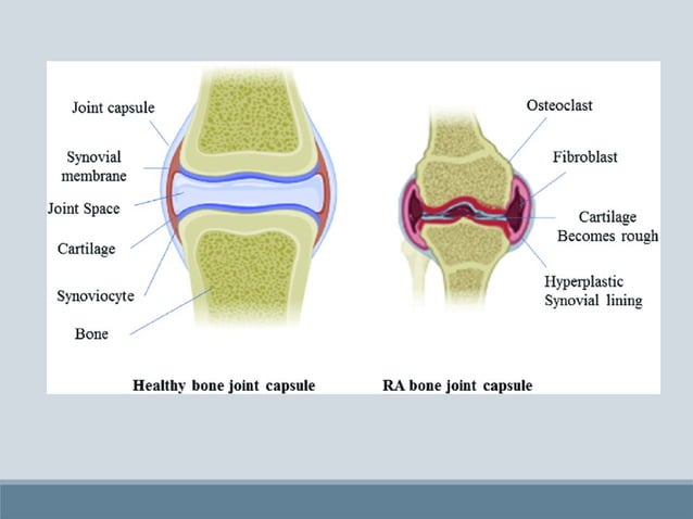 Disorders of Bones and Joints Pharm d.pptx