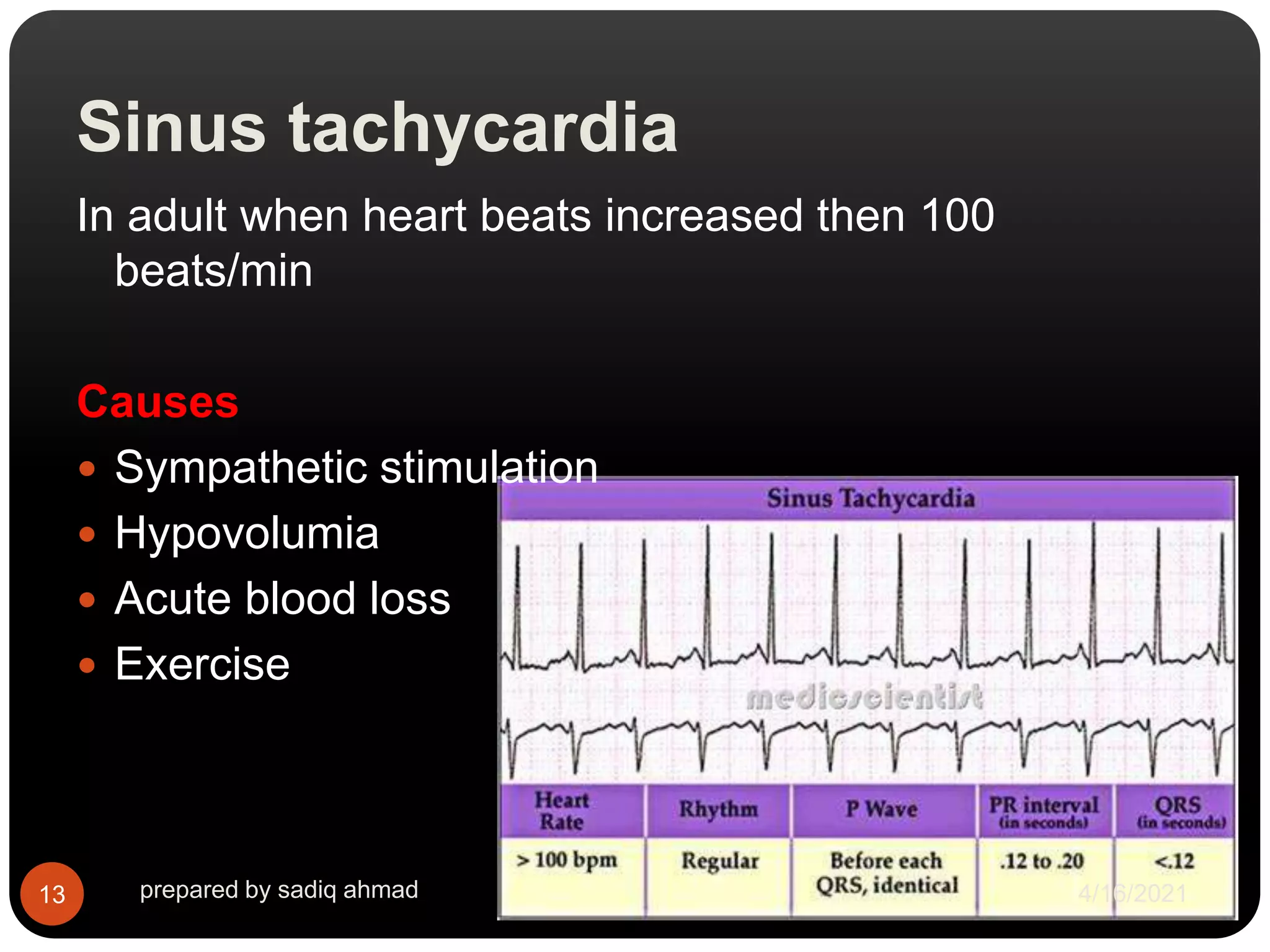 Disorders of cardiac conduction+heat blocks+pacemaker | PPTX