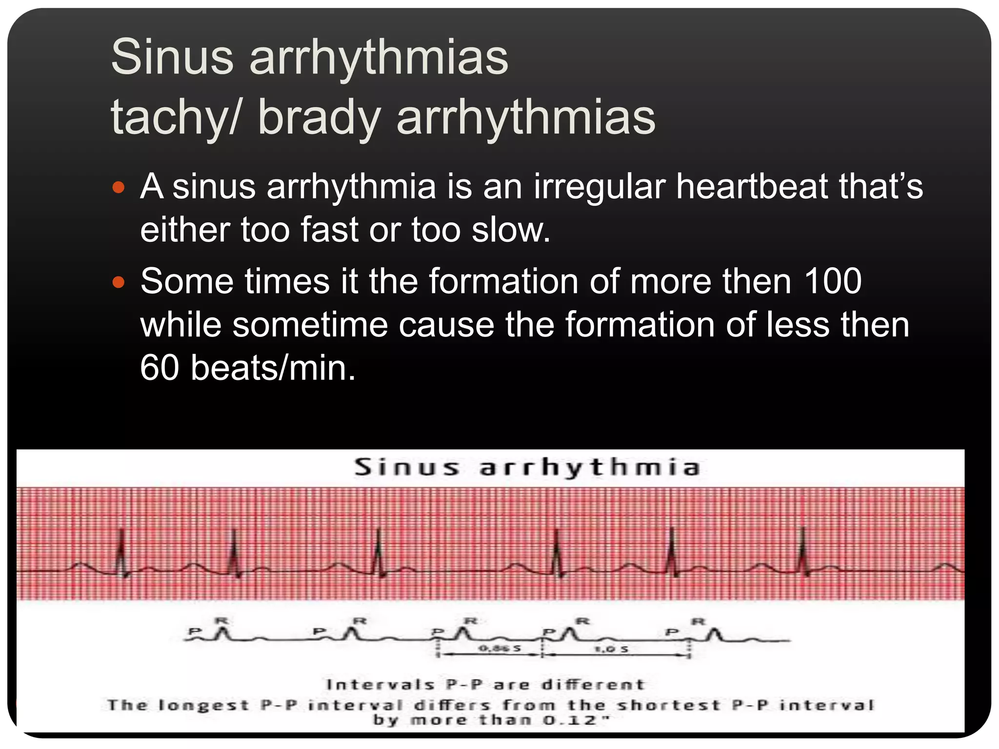 Disorders of cardiac conduction+heat blocks+pacemaker | PPTX